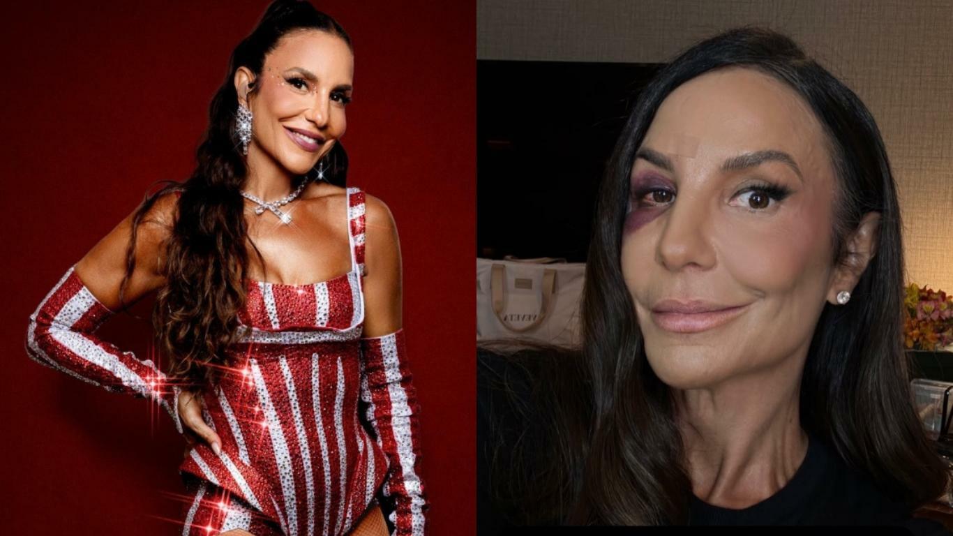 Após realizar show com olho roxo, Ivete Sangalo passa por cirurgia de 7 ...
