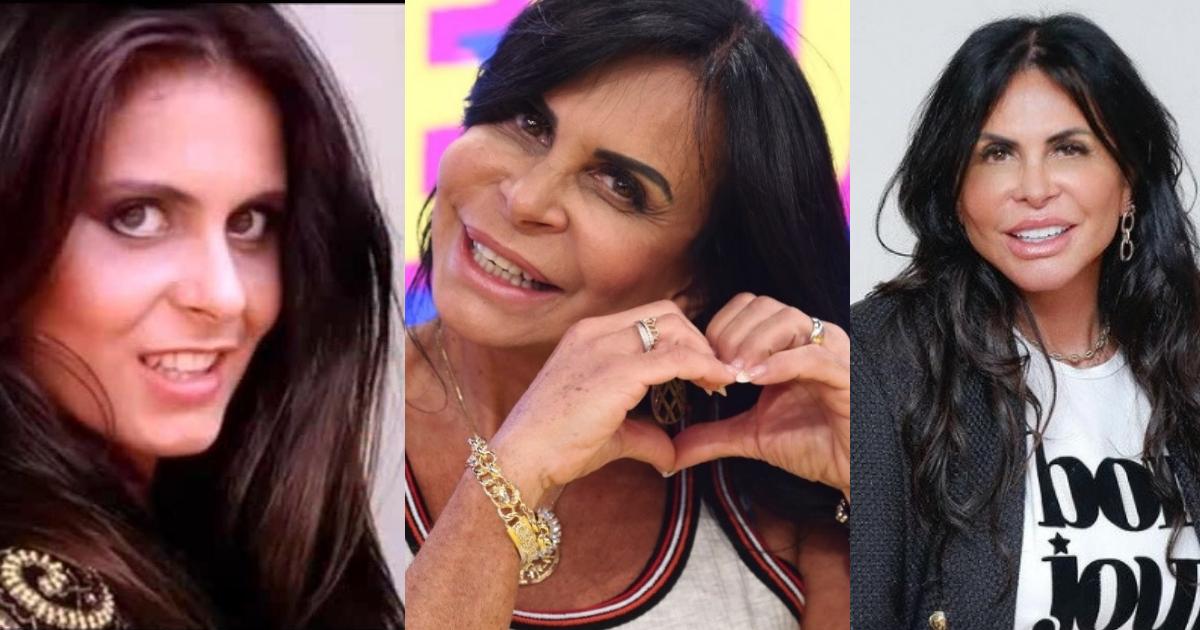 Famosos: veja antes e depois de Gretchen; fotos | Celebridades | O Liberal