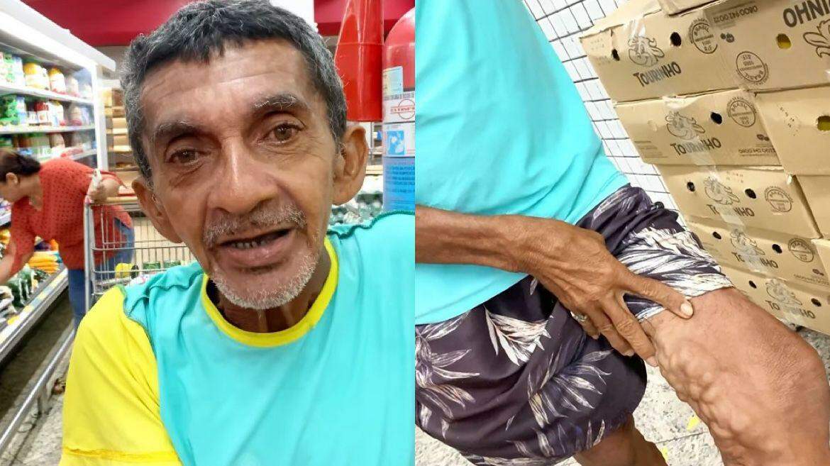'Viado da Bike' pede assistência para tratar varizes: 'uma ajuda é bem ...