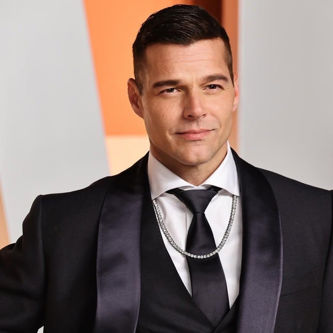 Bioestimulador, ácido hialurônico, botox? Veja o que Rick Martin fez ...